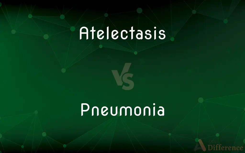 Atelectasis vs. Pneumonia — What’s the Difference?