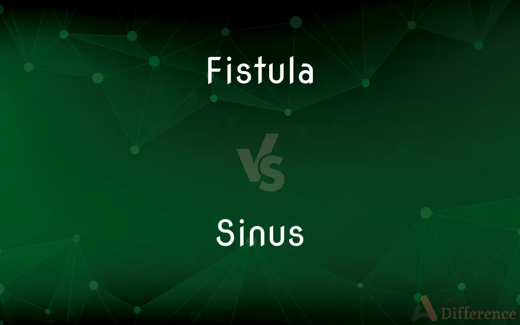 Fistula vs. Sinus — What’s the Difference?